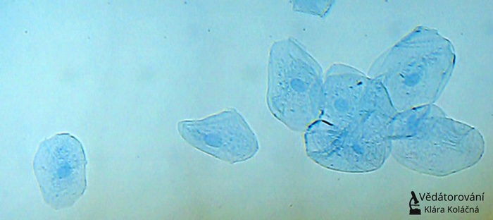 Buňky ústní sliznice :: vědátorování